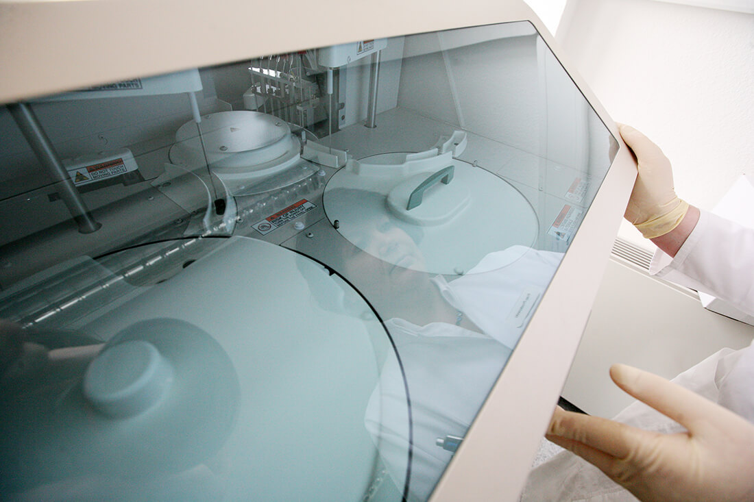 Labordiagnostik - Internisten Bonn-Gronau - Schönfelder, Göbel, Pape